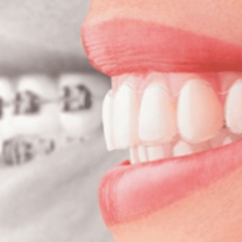 PureDent - PureDent - Stomatologia Estetyczna i Ortodoncja - Dentysta